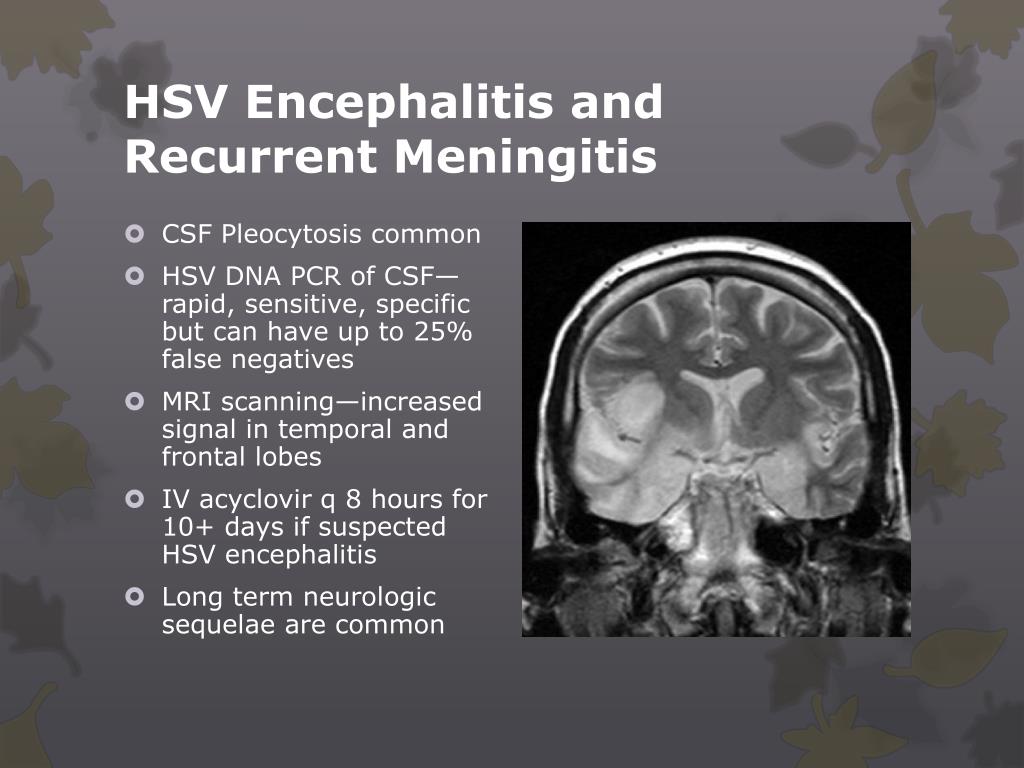 PPT - Clin Med II Infectious Disease PowerPoint Presentation, free ...