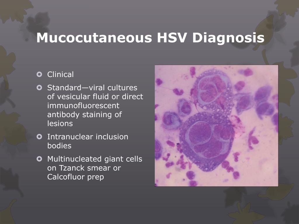 PPT - Clin Med II Infectious Disease PowerPoint Presentation, free ...