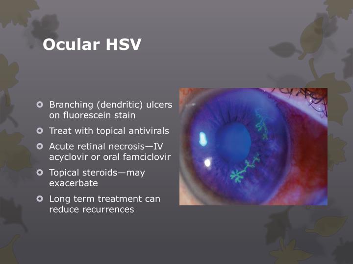 PPT - Clin Med II Infectious Disease PowerPoint Presentation - ID:2392517