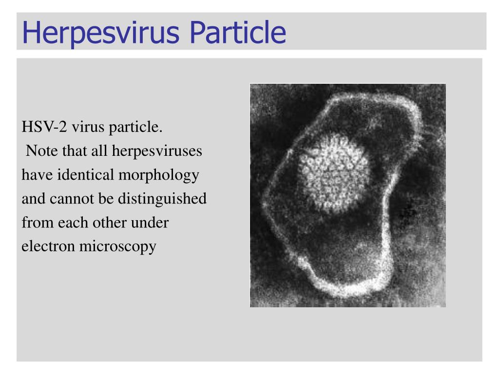PPT - Viral Infections of the Respiratory Tract PowerPoint Presentation ...