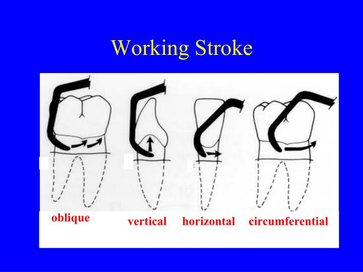 PPT - Periodontal Instrumentation PowerPoint Presentation - ID:2392653