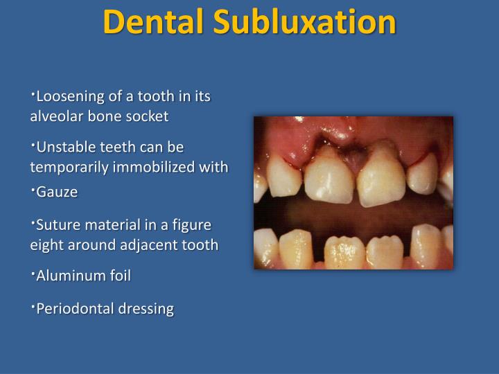 PPT - Facial Trauma PowerPoint Presentation - ID:2392727