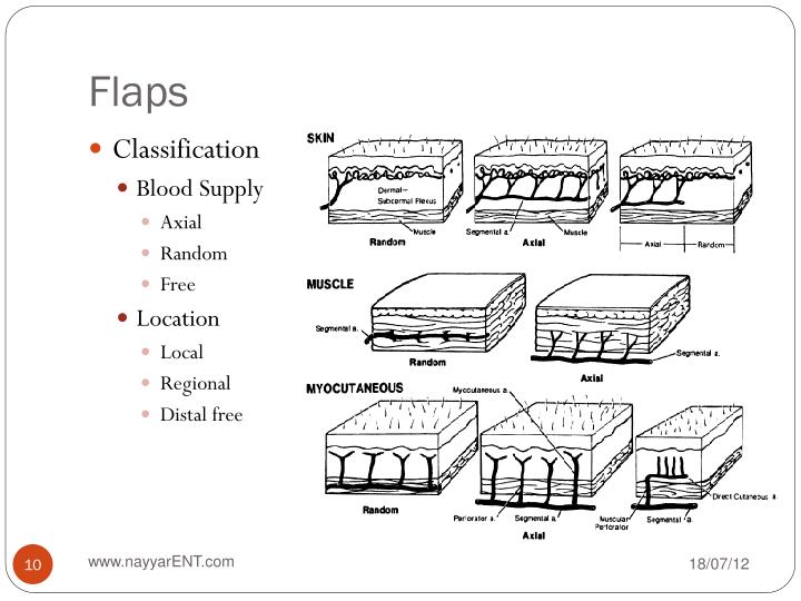 PPT - Grafts and Flaps in the Head and Neck PowerPoint Presentation ...