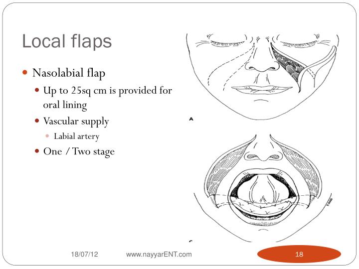 PPT - Grafts and Flaps in the Head and Neck PowerPoint Presentation ...