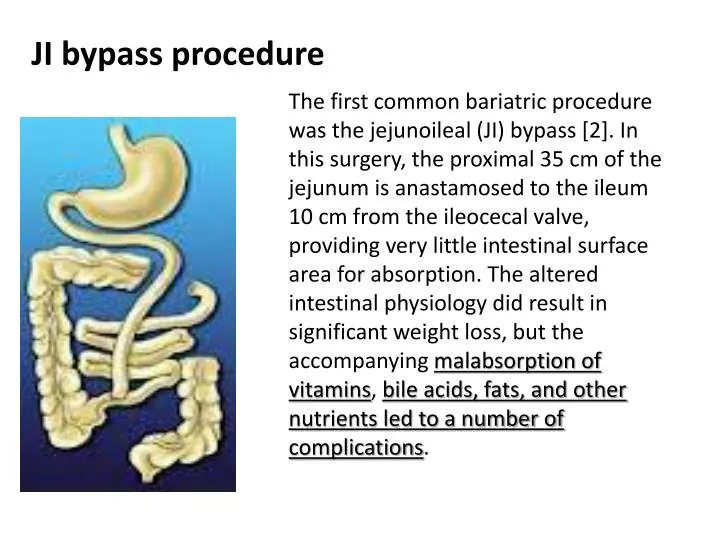 PPT - JI bypass procedure PowerPoint Presentation, free download - ID ...