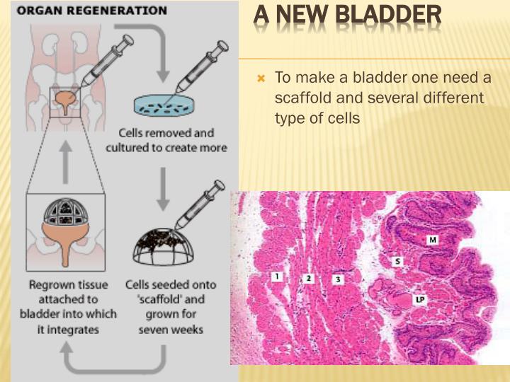 PPT - Tissue Engineering and Regenerative Medicine PowerPoint ...