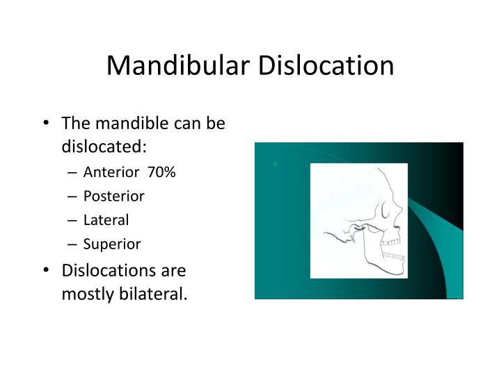 PPT - FRACTURES OF MAXILLA AND MANDIBLE PowerPoint Presentation - ID ...