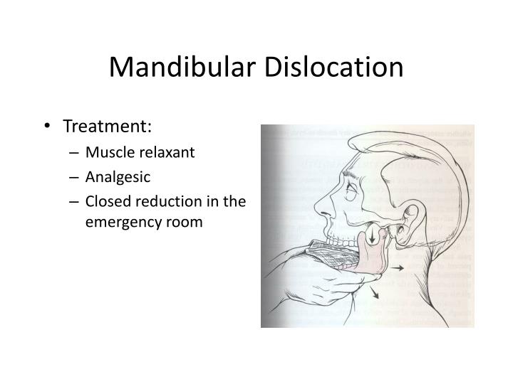 PPT - FRACTURES OF MAXILLA AND MANDIBLE PowerPoint Presentation - ID ...