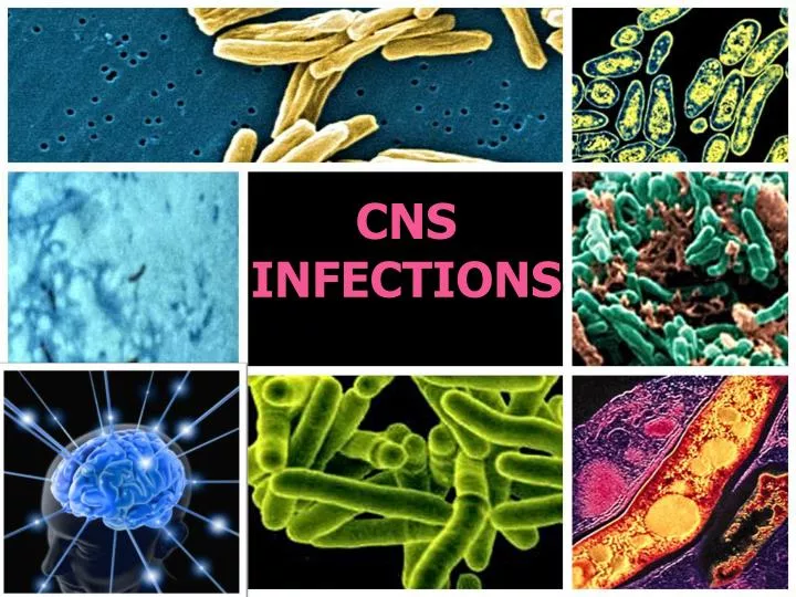 PPT - CNS INFECTIONS PowerPoint Presentation, free download - ID:2398688