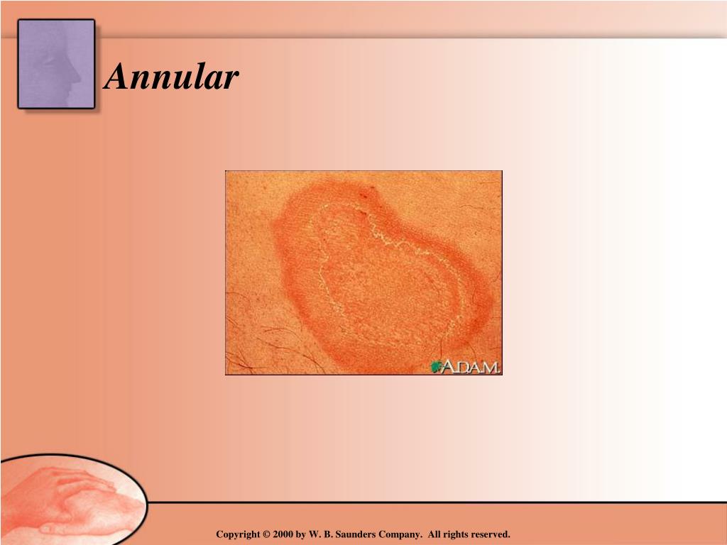 PPT - Assessment Physical Examination of the Skin By Sharon Kerr MSN ...