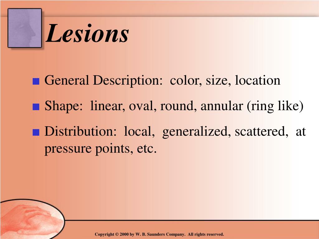 PPT - Assessment Physical Examination of the Skin By Sharon Kerr MSN ...