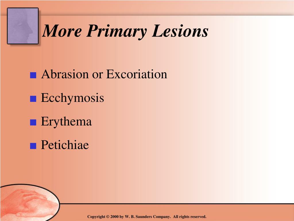 PPT - Assessment Physical Examination of the Skin By Sharon Kerr MSN ...