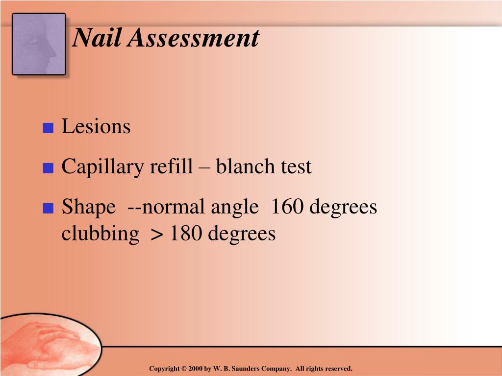 PPT - Assessment Physical Examination of the Skin By Sharon Kerr MSN ...