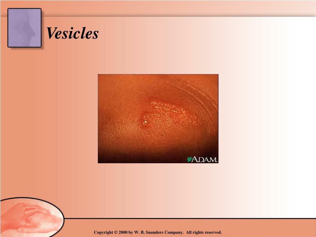 PPT - Assessment Physical Examination of the Skin By Sharon Kerr MSN ...