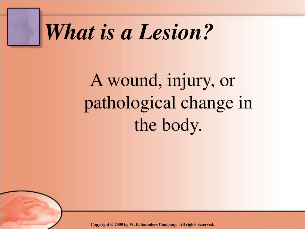 PPT - Assessment Physical Examination of the Skin By Sharon Kerr MSN ...