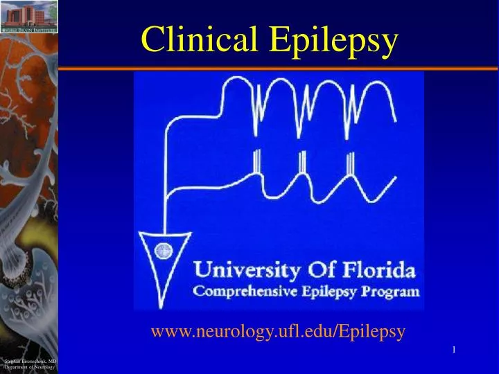PPT - Clinical Epilepsy PowerPoint Presentation, free download - ID:2399090