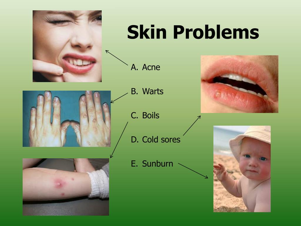 PPT - Healthy Skin, Hair, and Nails PowerPoint Presentation, free ...