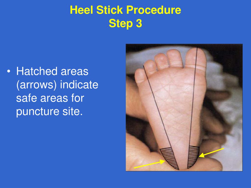PPT - Public Health Nurse Training PowerPoint Presentation, free ...