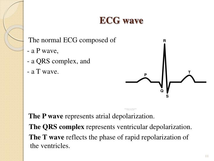 PPT - ECG Signal Processing PowerPoint Presentation - ID:2405464