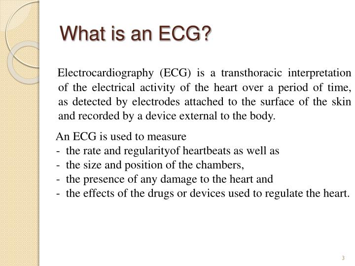 PPT - ECG Signal Processing PowerPoint Presentation - ID:2405464