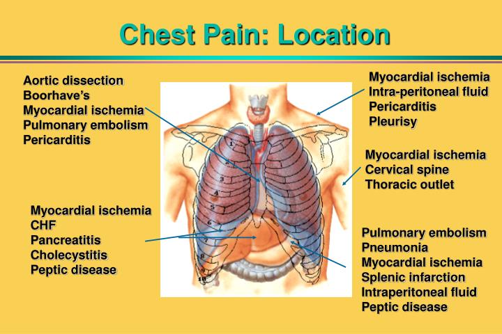 PPT - Evaluation of Chest Pain in the Emergency Department PowerPoint ...