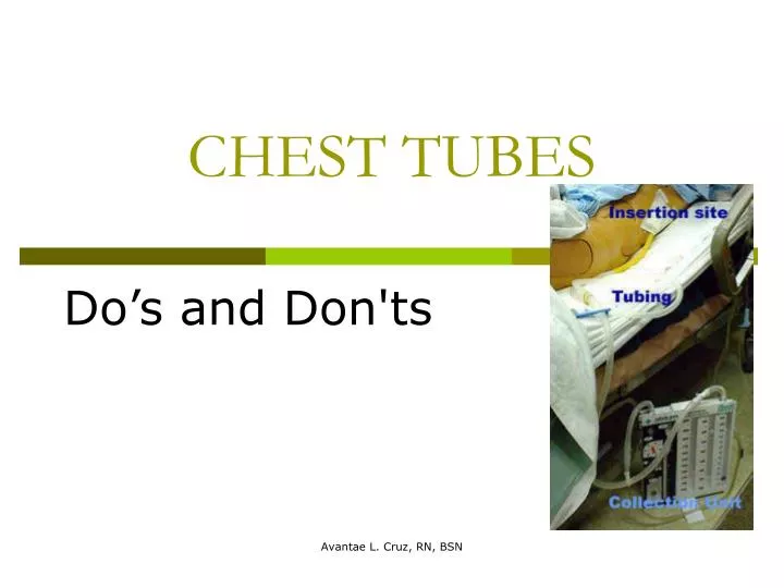 PPT - CHEST TUBES PowerPoint Presentation, free download - ID:2411078