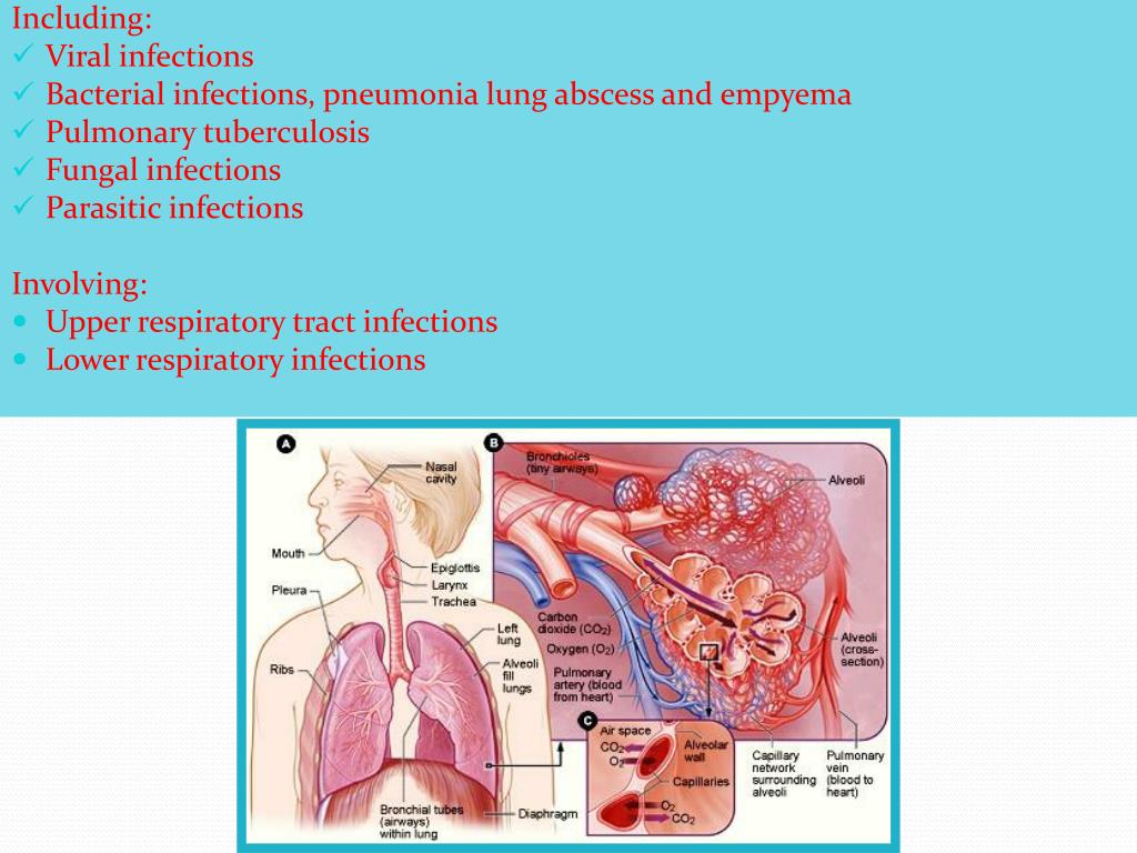 PPT - INFECTIONS OF THE RESPIRATORY SYSTEM PowerPoint Presentation ...