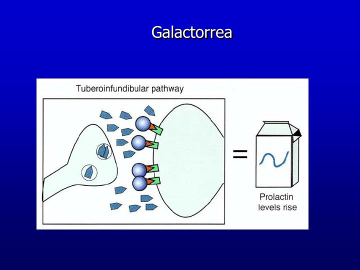 PPT - Psicosis y Esquizofrenia PowerPoint Presentation - ID:2414362