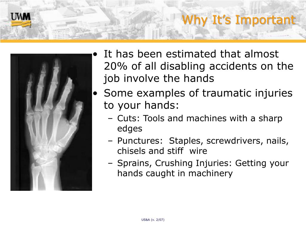 PPT - Personal Protective Equipment Department of University Safety ...