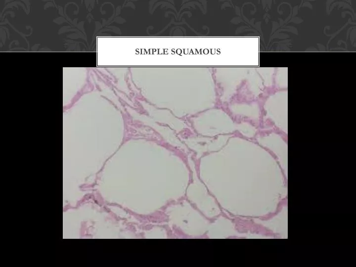 PPT - Simple Squamous PowerPoint Presentation, free download - ID:2420709
