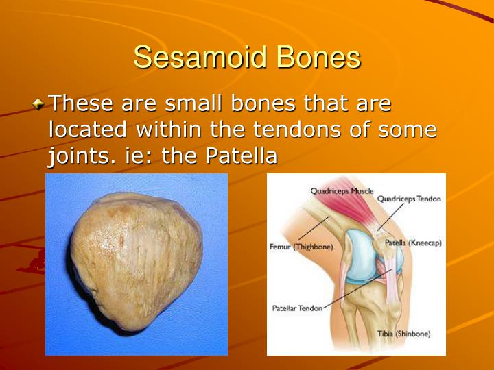 PPT - The Skeletal System PowerPoint Presentation - ID:2425236