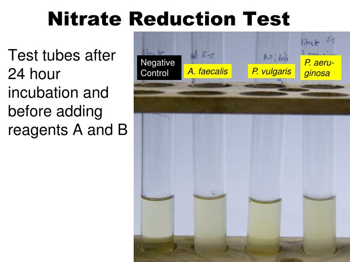 PPT - Ex. 17: Nitrate Respiration (Nitrate Reduction Test) PowerPoint ...