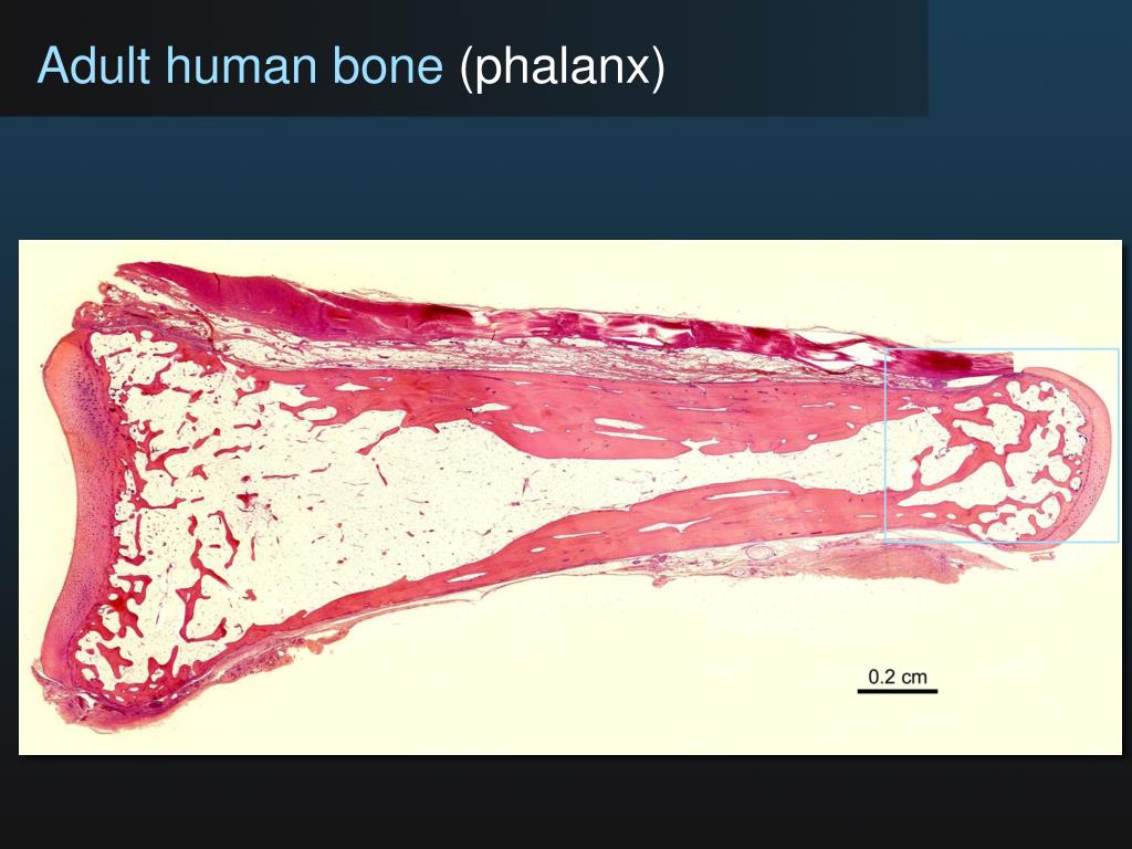 PPT - Adult human bone (phalanx) PowerPoint Presentation, free download ...
