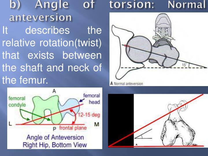 PPT - Pathomechanics of hip Joint (part 1) practical section PowerPoint ...