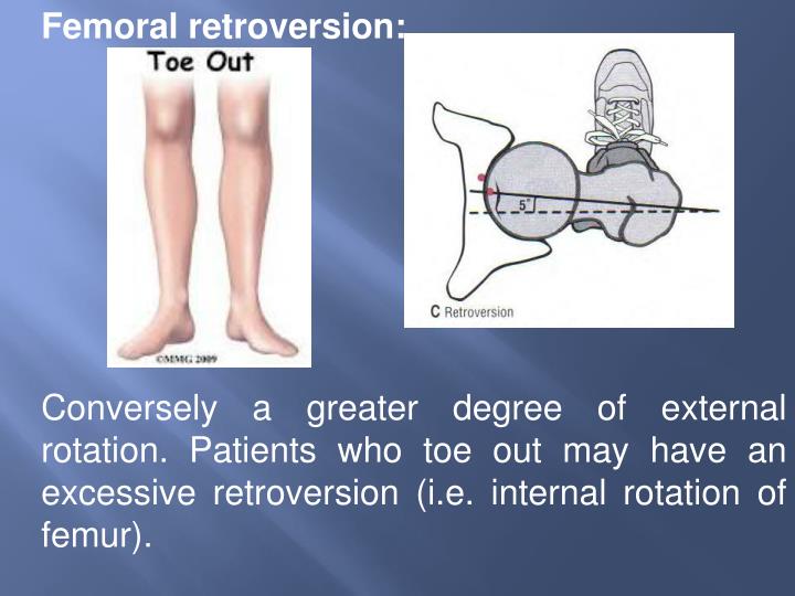 PPT - Pathomechanics of hip Joint (part 1) practical section PowerPoint ...