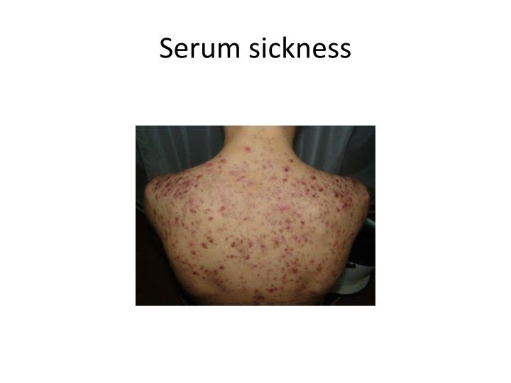 PPT - IMMUNITY PowerPoint Presentation - ID:2432676