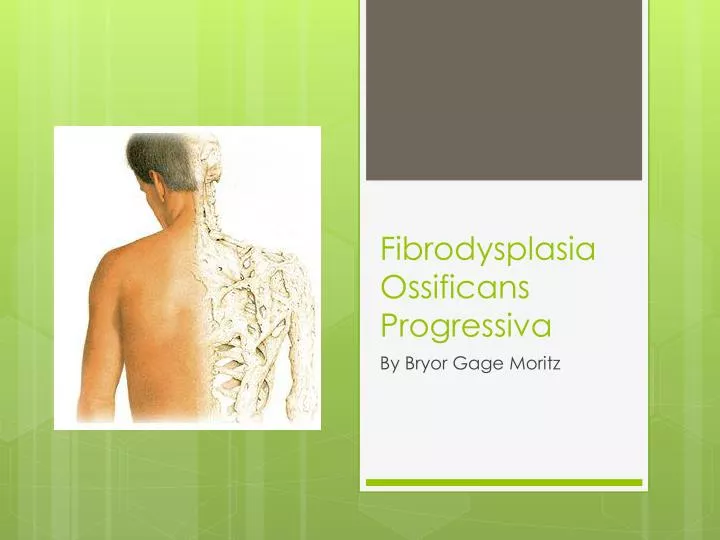 PPT - Fibrodysplasia Ossificans Progressiva PowerPoint Presentation ...