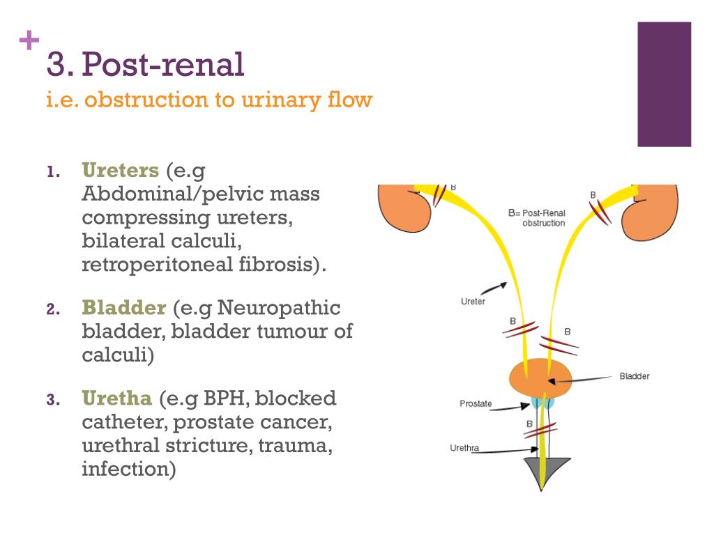 PPT - Causes of Acute Kidney Injury PowerPoint Presentation, free ...