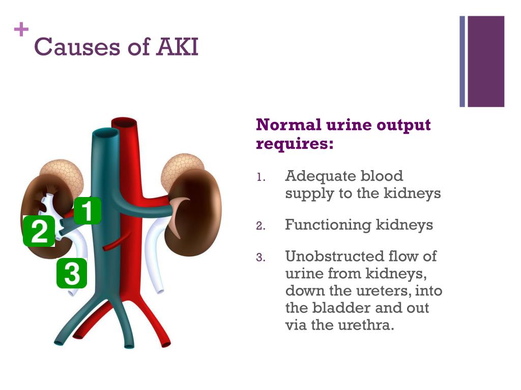 PPT - Causes of Acute Kidney Injury PowerPoint Presentation, free ...