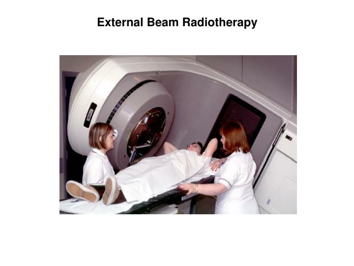 PPT - Treatment for Cervical Cancer PowerPoint Presentation - ID:2439386