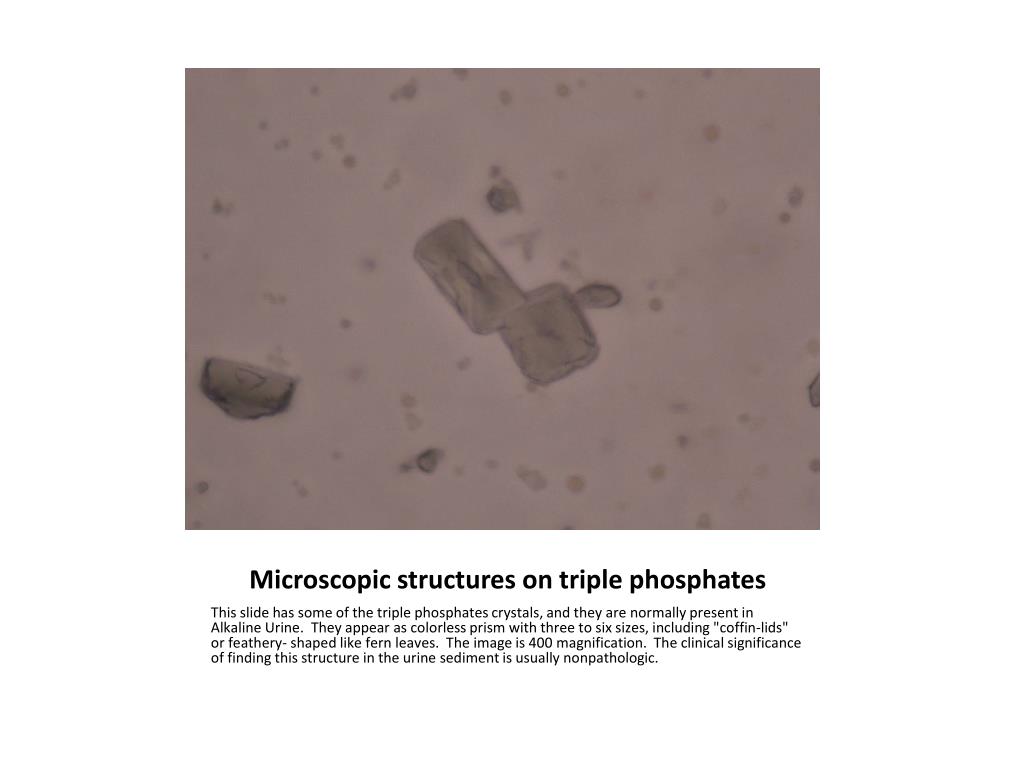 PPT - Urinalysis in Pictures by Yen Truong PowerPoint Presentation ...