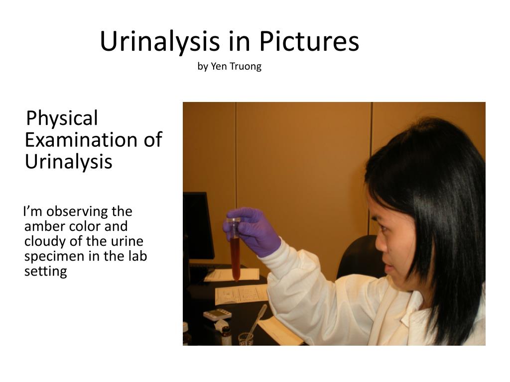 PPT - Urinalysis in Pictures by Yen Truong PowerPoint Presentation ...
