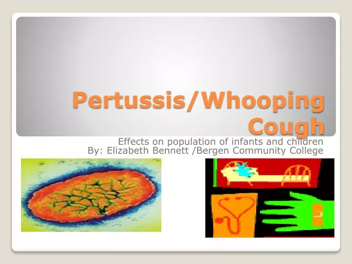 PPT - Pertussis /Whooping Cough PowerPoint Presentation, free download ...