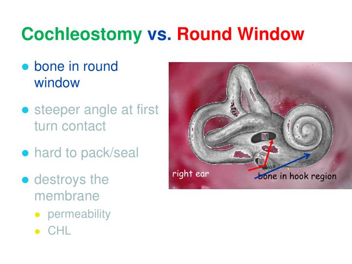 PPT - Round Window/Cochleostomy PowerPoint Presentation - ID:2449648