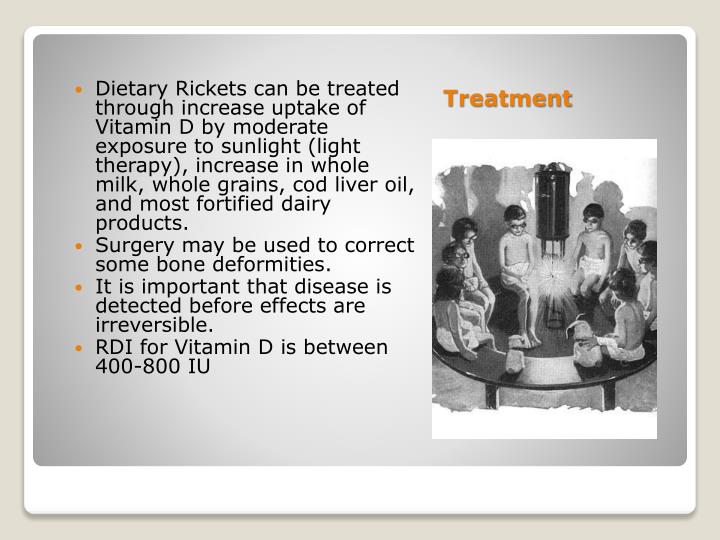 PPT - Rickets PowerPoint Presentation - ID:2451262