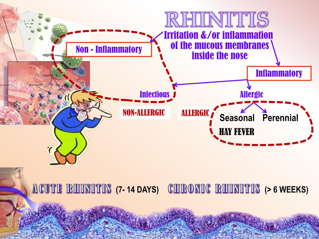 PPT - RHINITIS & COUGH PowerPoint Presentation, free download - ID:2451574
