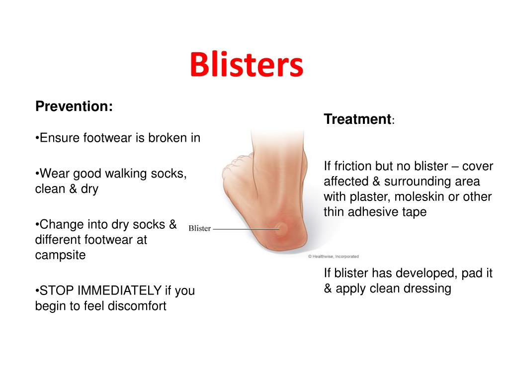 PPT - Duke of Edinburgh’s Award Bronze First Aid Training PowerPoint ...