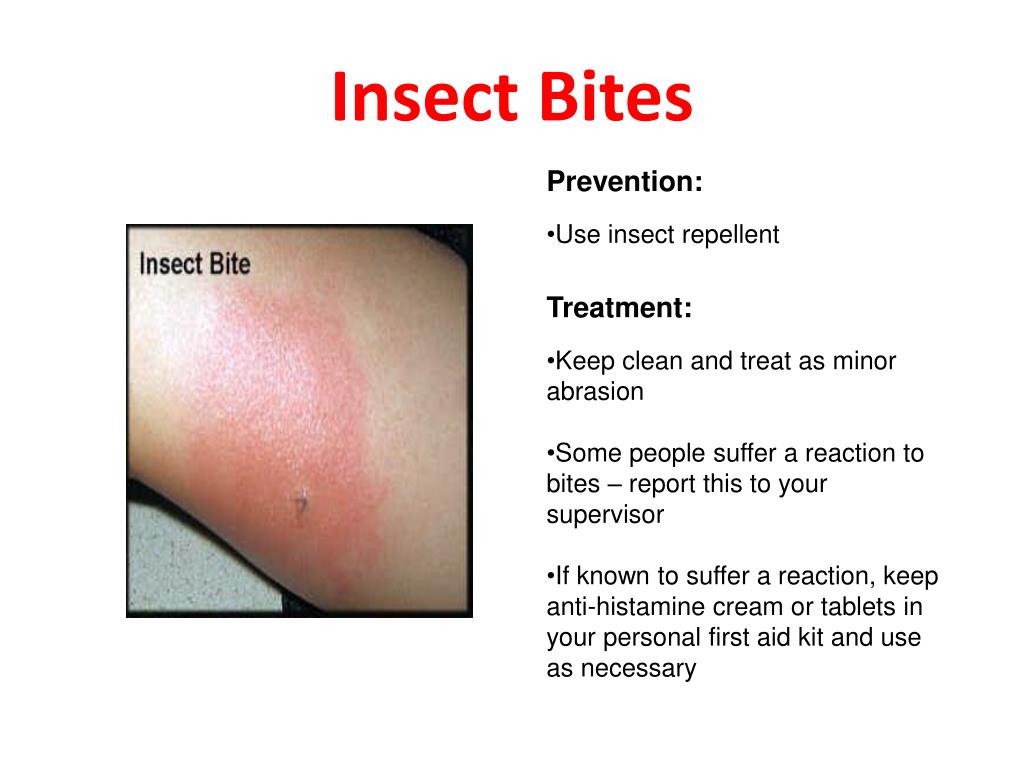 PPT - Duke of Edinburgh’s Award Bronze First Aid Training PowerPoint ...