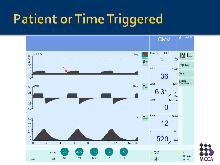 PPT - Synchronized Intermittent Mandatory Ventilation: SIMV PowerPoint ...