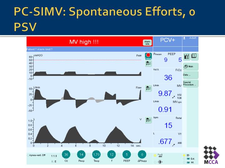 PPT - Synchronized Intermittent Mandatory Ventilation: SIMV PowerPoint ...